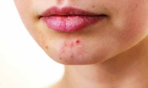5 Chinen Salt Benefits: Is It The Best Natural Salt?